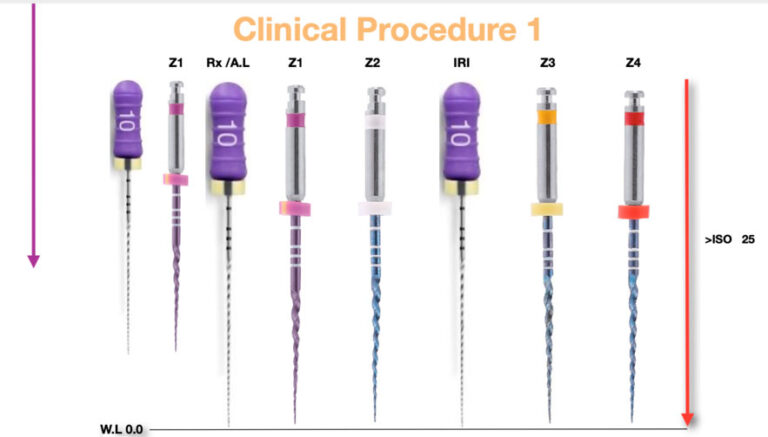 Zarc4Endo | Advantages of using BlueShaper on tooth with three canals