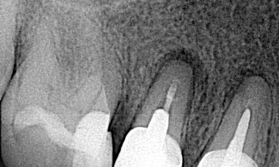Zarc4Endo | From odontologists to odontologists (O2O)