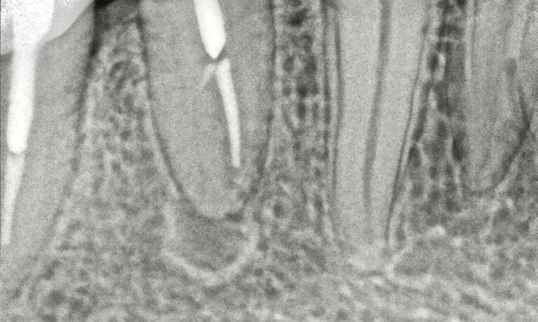 Zarc4Endo | From odontologists to odontologists (O2O)